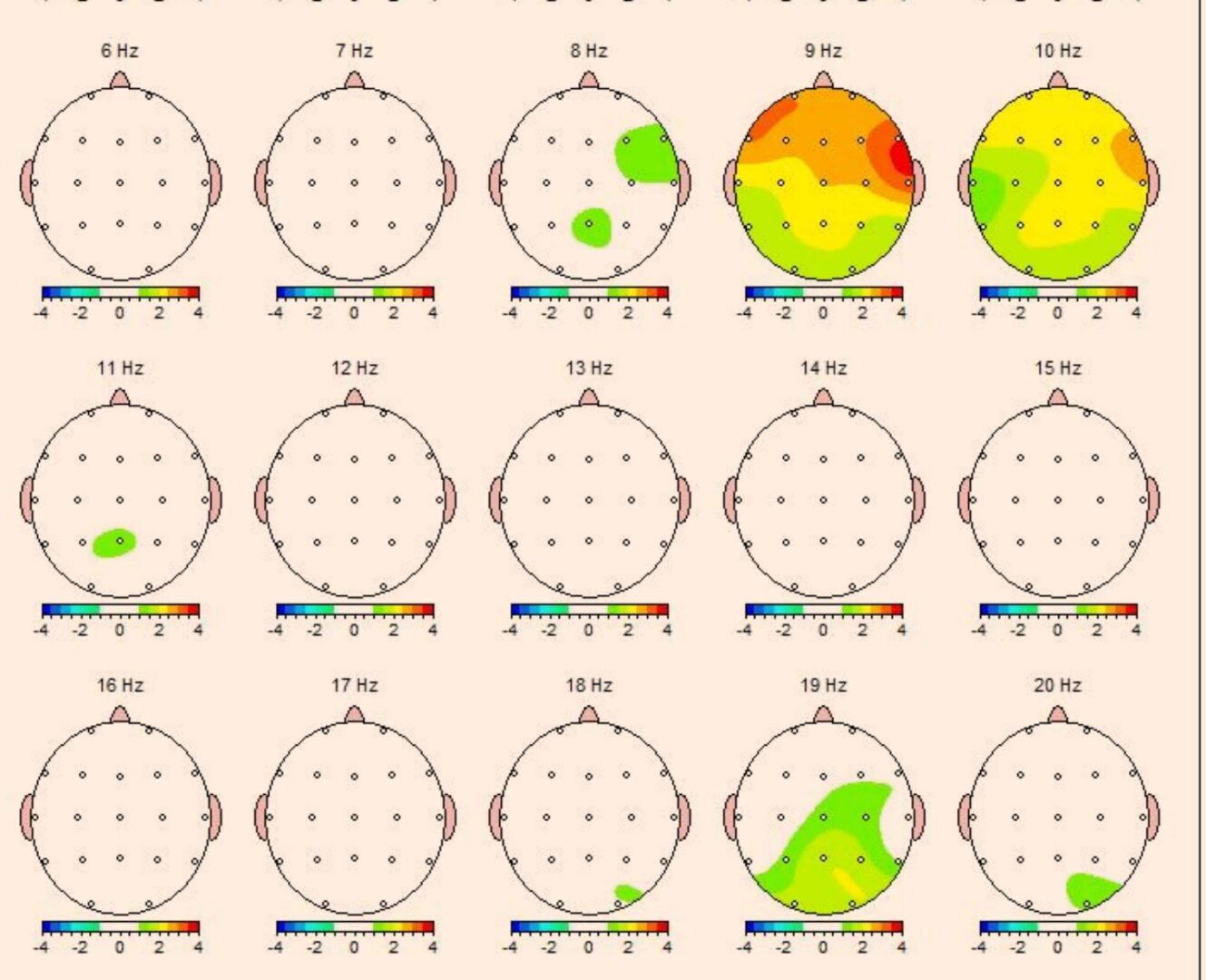 Remote Neurofeedback: Hack Your Brain From Anywhere In The World